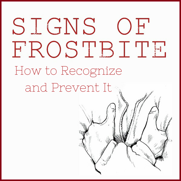How to Recognize and Prevent Frostbite